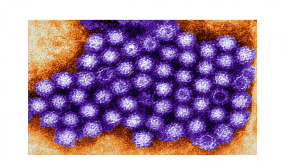 Norovirus – National Collaborating Centre for Infectious Diseases