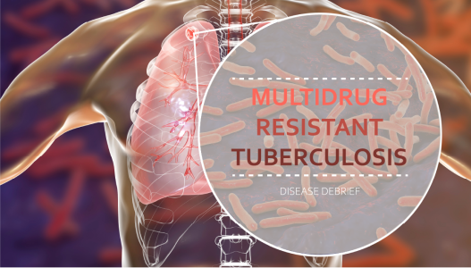 Multidrug Resistant Tuberculosis – National Collaborating Centre for ...