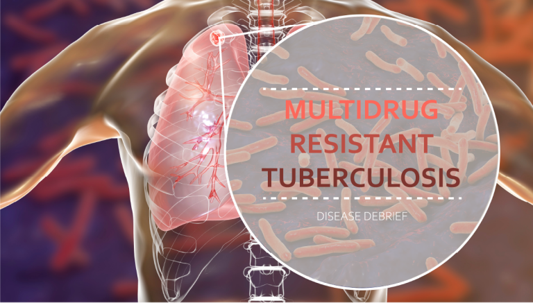 Multidrug Resistant Tuberculosis – National Collaborating Centre for ...